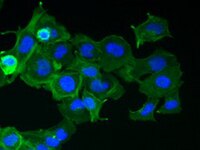 UM-SCC-105 Human Squamous Carcinoma Cell Line | SCC189